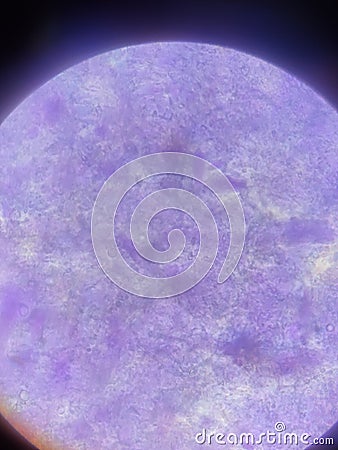 The Brain Of A Pig Under The Microscope Royalty-Free Stock Photography ...