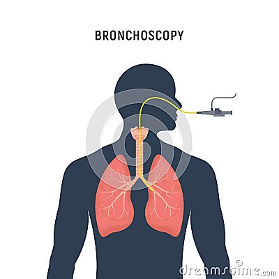 Bronchoscopy Respiratory System Emphysema Endoscopy Human Lung ...