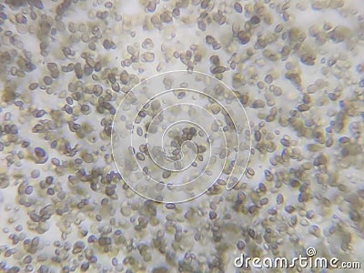 Candida Albicans Under The Microscope Stock Photo | CartoonDealer.com ...