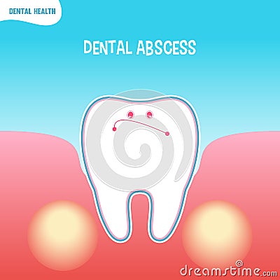 Cartoon Bad Tooth Icon With Dental Abscess Stock Photography ...