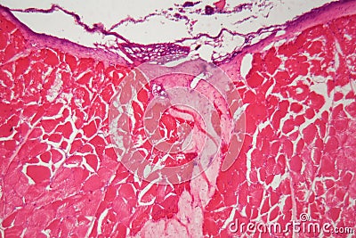 Fish Skin Injured By Chemicals Under The Microscope Stock Photo ...