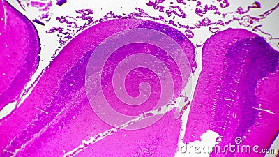 Cerebellum of the Human Being in Section Under Microscope 40x Against ...