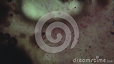 Chemical Reactions Under Microscope Stock Video - Video of ...