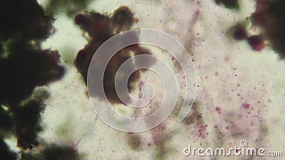 Chemical Reactions Under Microscope Stock Video - Video of chemistry ...