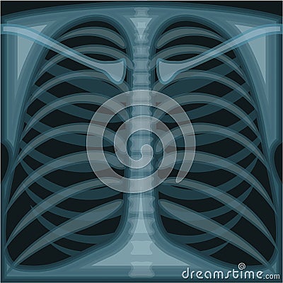 Chest X-ray Cartoon Vector | CartoonDealer.com #41538023