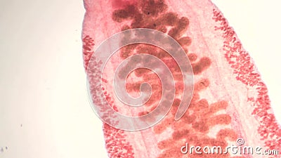 Chinese liver fluke stock footage. Video of fixed, oligochaeta - 237520992