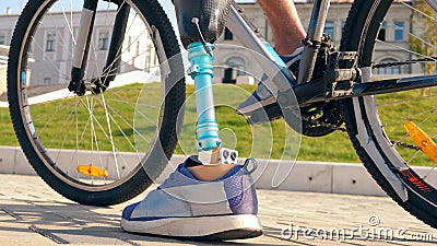 Close Up of Bionic Hand is Being Hold by the Professional. Stock ...