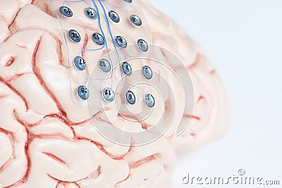 Subdural Grid Electrode For Brain Waves Recording On The Brain Model ...