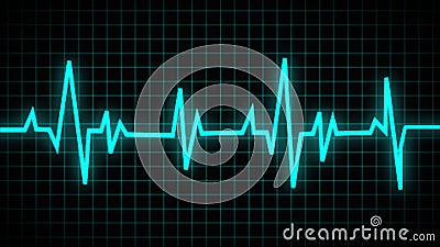 Collection Of Normal And Abnormal ECGs. Vector Of An Electrocardiogram ...
