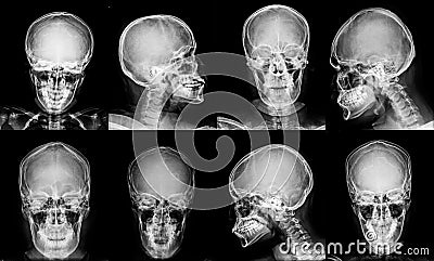 Xray/Face side stock image. Image of health, disease, diagnosis - 198831