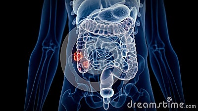 Colon cancer stock footage. Video of healthy, anatomy - 68294166