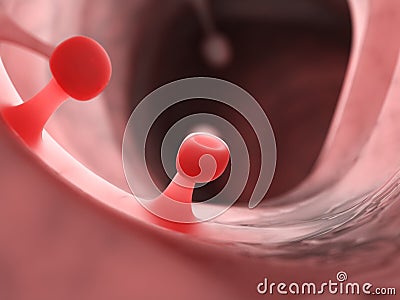 Colon Polyps Royalty-Free Cartoon | CartoonDealer.com #162288461