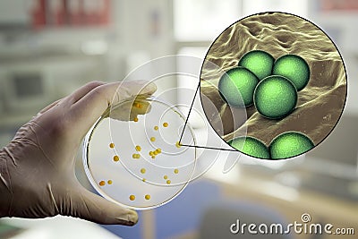 Colonies Of Micrococcus Luteus Bacteria On Agar Plate Royalty-Free ...