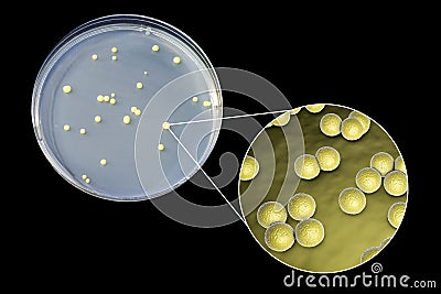 Colonies Of Micrococcus Luteus Bacteria On Agar Plate Royalty-Free ...