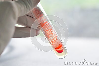 Colony In Slant Agar Stock Photo - Image: 43355898