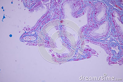 Columnar Epithelium Of Human Gall Bladder Under The Microscope In Lab ...