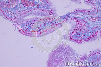 Columnar Epithelium Of Human Gall Bladder Under The Microscope In Lab ...