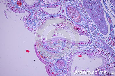 Columnar Epithelium Of Human Gall Bladder Under The Microscope In Lab ...