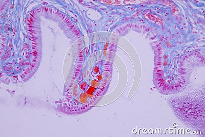 Columnar Epithelium Of Human Gall Bladder Under The Microscope In Lab ...