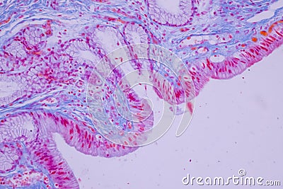 Columnar Epithelium Of Human Gall Bladder Under The Microscope In Lab ...
