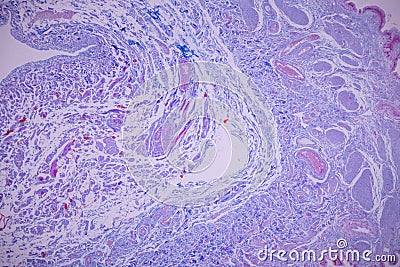 Columnar Epithelium Of Human Gall Bladder Under The Microscope In Lab ...