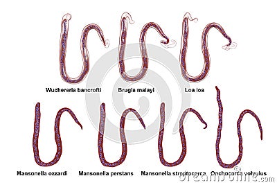 Comparison Of Microfilariae Morphology Stock Illustration ...