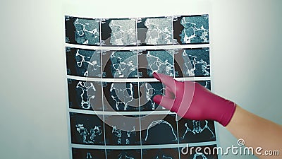 Computed Tomography in the Hands of a Doctor Close Up. the CT Scan ...