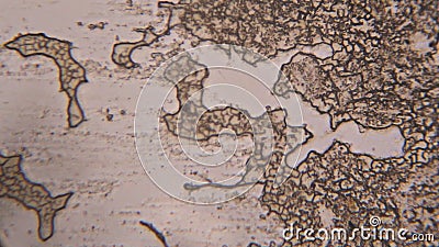 Congealed Blood Cells Under the Microscope Stock Video - Video of ...