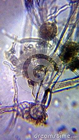 Aspergillus Niger The Black Mold Conidia Under The Microscope Royalty ...