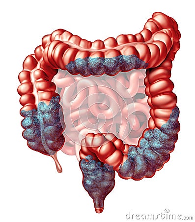 Constipation Anatomy Stock Illustration | CartoonDealer.com #276948784