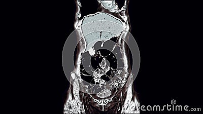 X-ray of the Gastrointestinal Tract. Radiography of the Stomach Stock ...