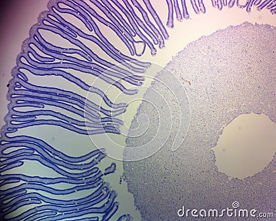 Coprinus Mushroom Section Stained Stock Photo - Image: 62014493