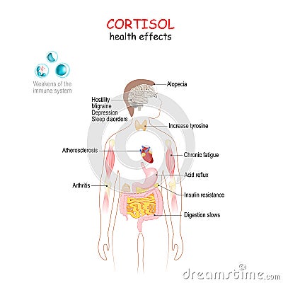 Cortisol Health Effects. Human`s Body With Internal Organs Affected By ...
