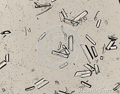 Cristales Triples Del Fosfato Foto de archivo - Imagen: 83444165