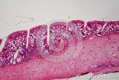 Ciliated Epithelium Under The Microscope. Royalty-Free Stock Photo ...