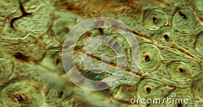 Cross-section of Decalcified Bone Stock Footage - Video of medic, check ...