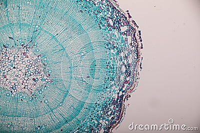 Cross-section Dicot, Monocot And Root Of Plant Stem Under The ...