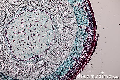 Cross-section Dicot, Monocot And Root Of Plant Stem Under The ...