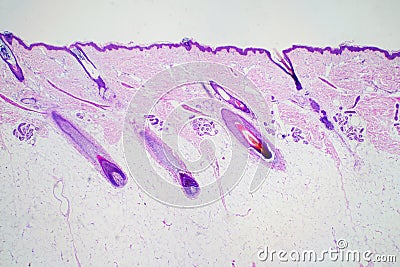 Cross Section Human Skin Head Under Microscope View For Education ...