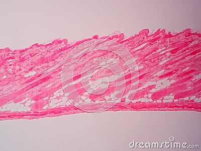 Cross Section Human Skin Tissue Royalty-Free Stock Photo ...