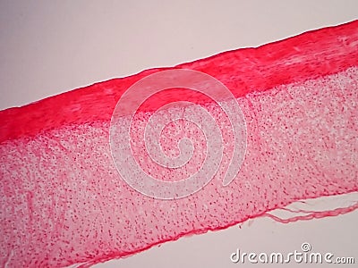Cross Section Human Tendon Royalty-Free Stock Photo | CartoonDealer.com ...