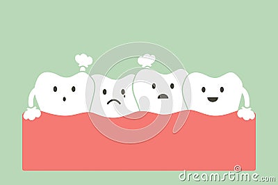 Crowding Teeth Malocclusion Vector Illustration | CartoonDealer.com ...