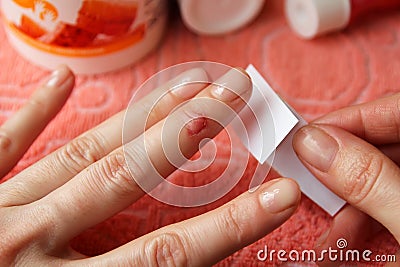 The Cut On His Finger And Plaster Royalty-Free Stock Photography ...