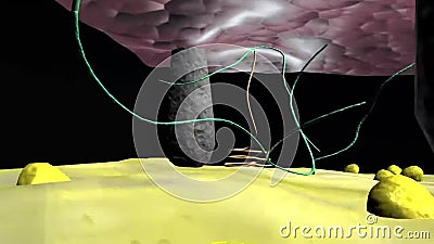 3d Animation of Hair Loss Proceeded by Nutrient Deficiency. Dermatology ...