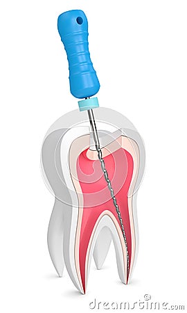 3d Render Of Tooth With Endodontic File Stock Photo | CartoonDealer.com ...