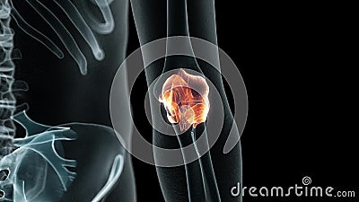 A painful elbow stock footage. Video of health, injury - 140253532