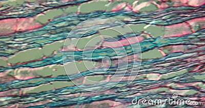 Dandelion Taproot Lengthways Stock Video - Video of meadow ...