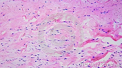 Dense Connective Tissue in Longitudinal Section Filmed by Microscope ...