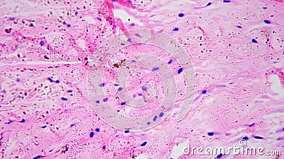 Dense Connective Tissue in Longitudinal Section Under Microscope 400x ...