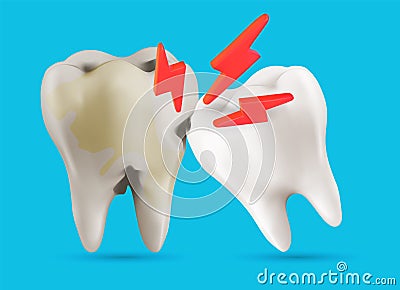 Dental: Toothache And Wisdom Teeth, Tooth Wrong Tilted. Wisdom Tooth ...